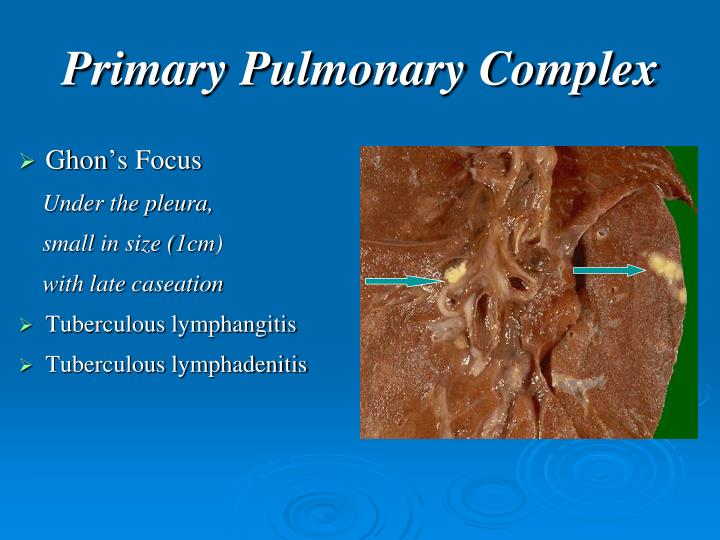 PPT - Lung Pathology TUBERCULOSIS PowerPoint Presentation - ID:3595637