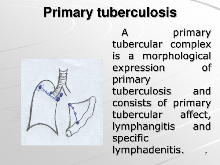 PPT - Pathological anatomy of TUBERCULOSIS PowerPoint Presentation - ID ...