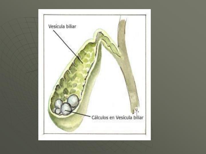 PPT - COLELITIASIS PowerPoint Presentation - ID:3595893