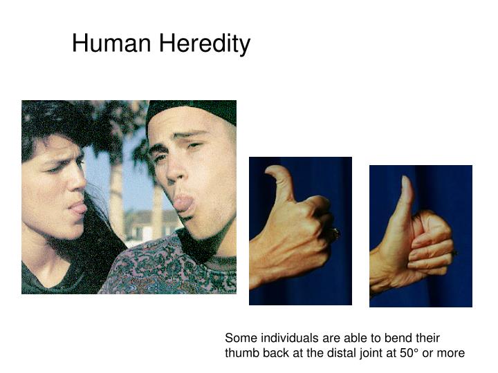 PPT - Some individuals are able to bend their thumb back at the distal ...