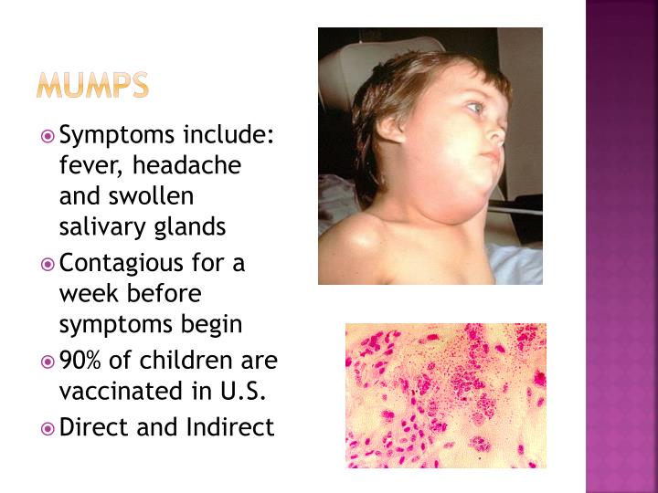 PPT - SICk by Shel Silverstein PowerPoint Presentation - ID:3599809