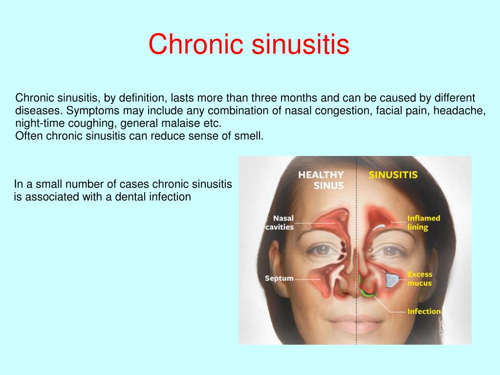 Ppt Basic Principles Of Infectious Diseases Powerpoint Presentation