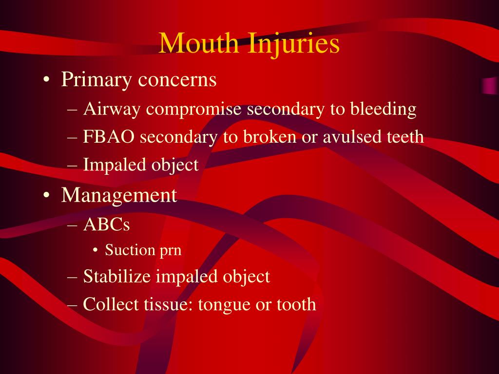 PPT - Maxillofacial, Ophthalmic & Dental Trauma PowerPoint Presentation ...