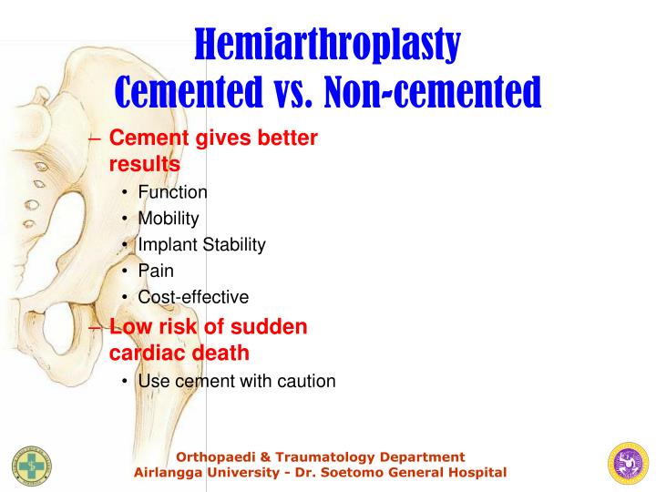 PPT - Oleh Mohammad Zaim Chilmi Department of Orthopaedic ...