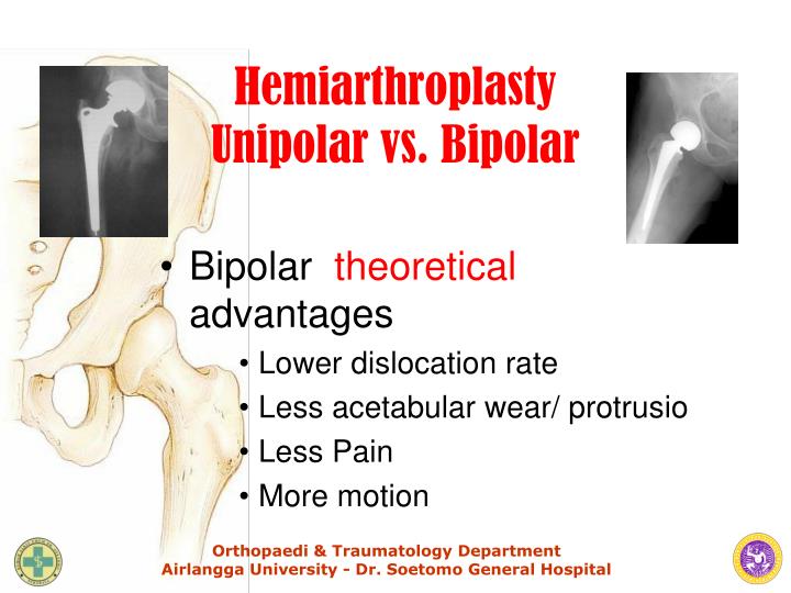 PPT - Oleh Mohammad Zaim Chilmi Department of Orthopaedic ...