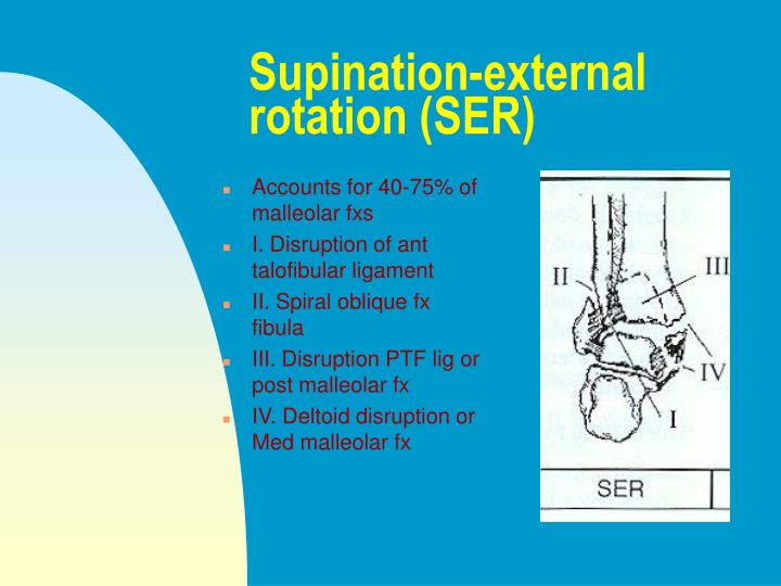 PPT - ANKLE FRACTURES PowerPoint Presentation - ID:3603223